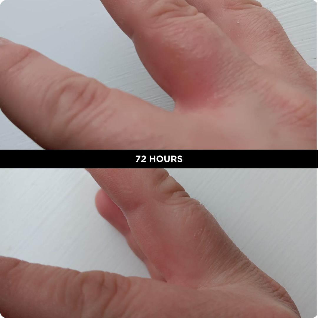 Before and Afters – WONDERBALM